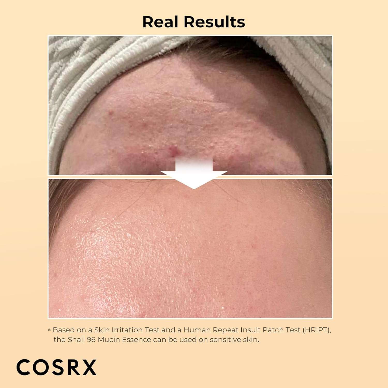 CORSX Snail serum | سيزما